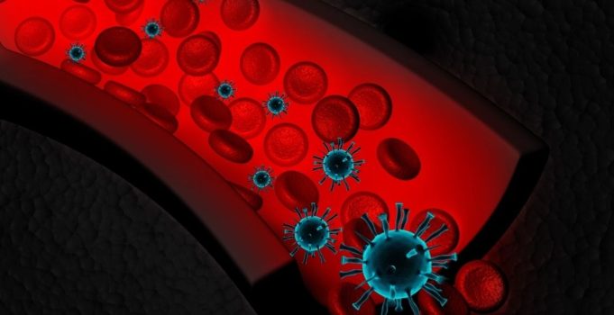 La sepsis: qué es y cuáles son sus síntomas - Selecciones